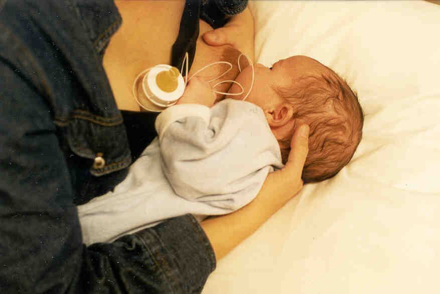 Lactation Aid – International BreastFeeding Centre